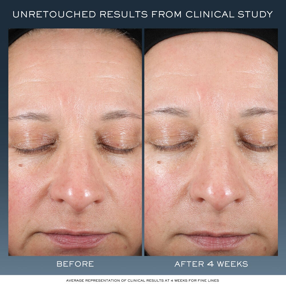 Advanced Génifique Repairing & Restorative Night Cream - Lancôme